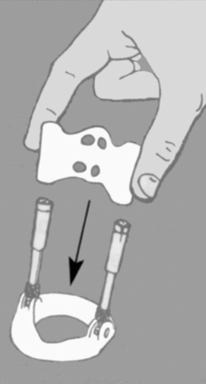 Quick Extender Pro Instructions